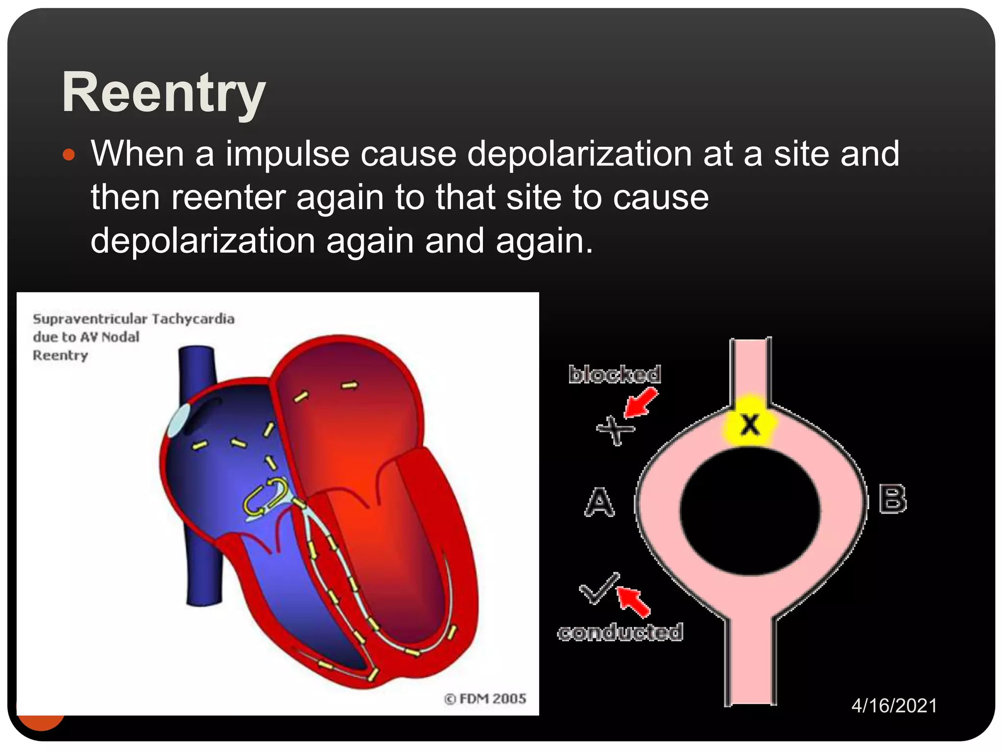 Disorders of cardiac conduction+heat blocks+pacemaker | PPTX