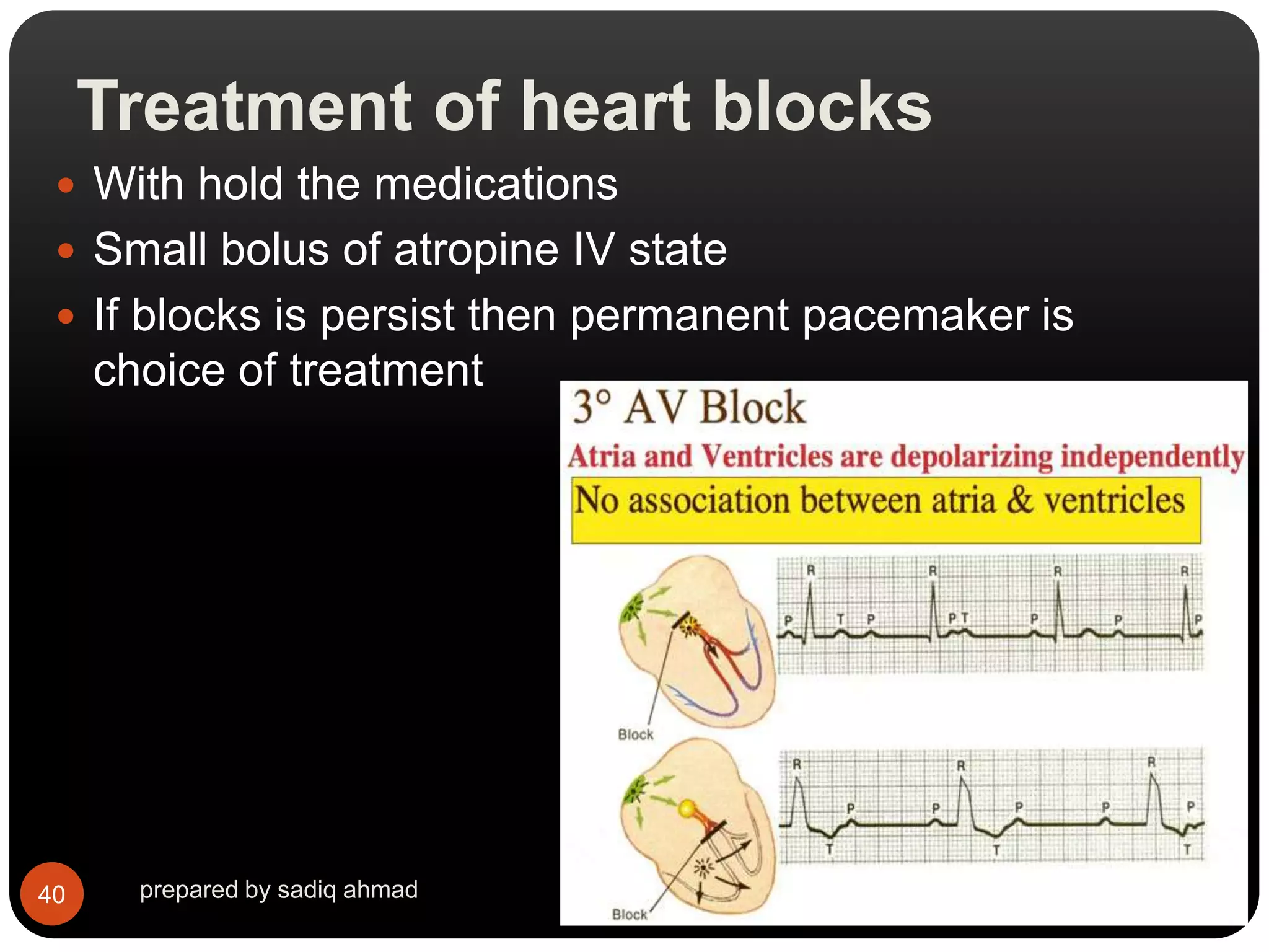 Disorders of cardiac conduction+heat blocks+pacemaker | PPT