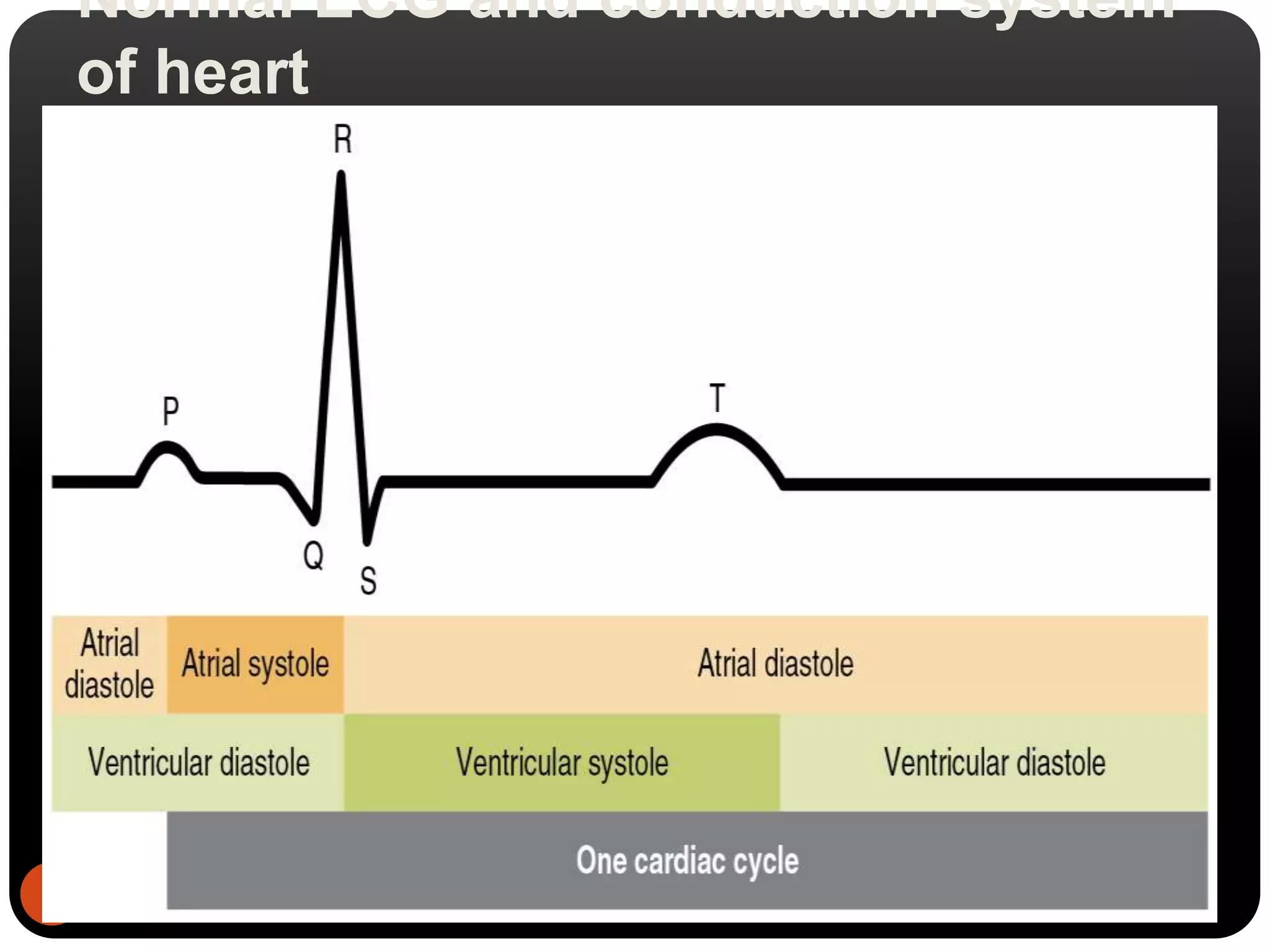 Disorders of cardiac conduction+heat blocks+pacemaker | PPTX