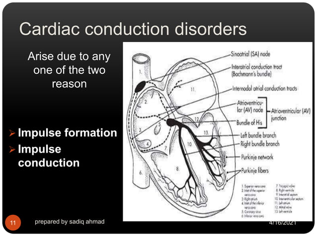 Disorders of cardiac conduction+heat blocks+pacemaker | PPT