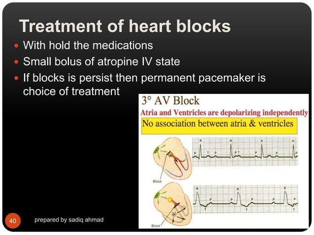 Disorders of cardiac conduction+heat blocks+pacemaker | PPT