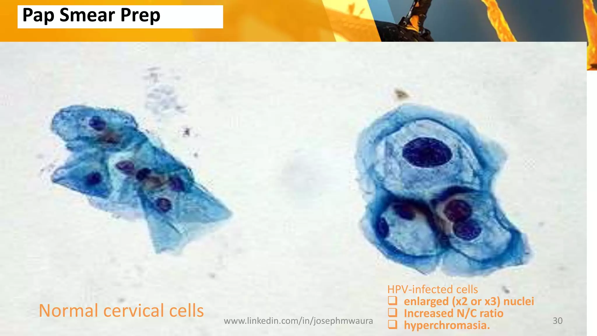 Disorders of cell growth - Dr Mwaura | PPTX