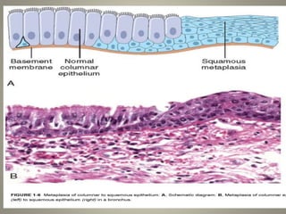 Disorders of cell growth and differentiation | PPTX