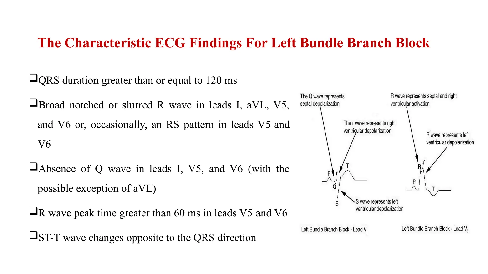 Disorders of Conduction of Heart- Interpretation and Management | PPTX