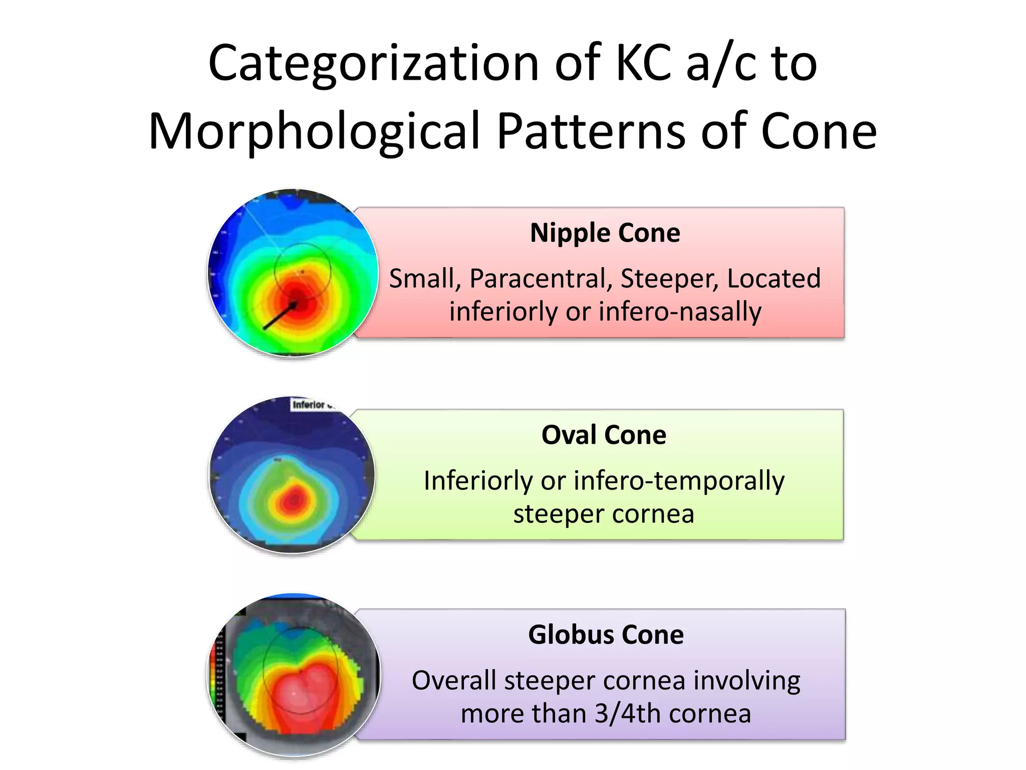 Disorders of cornea: Ectatic Disorders, Corneal Dystrophy and ...