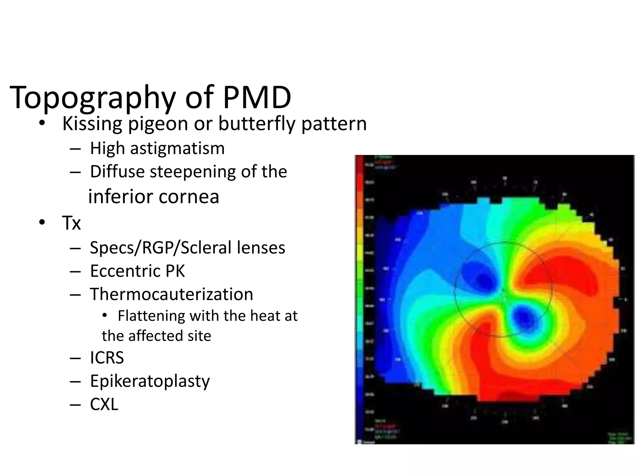 Disorders of cornea: Ectatic Disorders, Corneal Dystrophy and ...