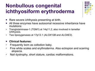 Non Bullous Congenital Ichthyosiform Erythroderma