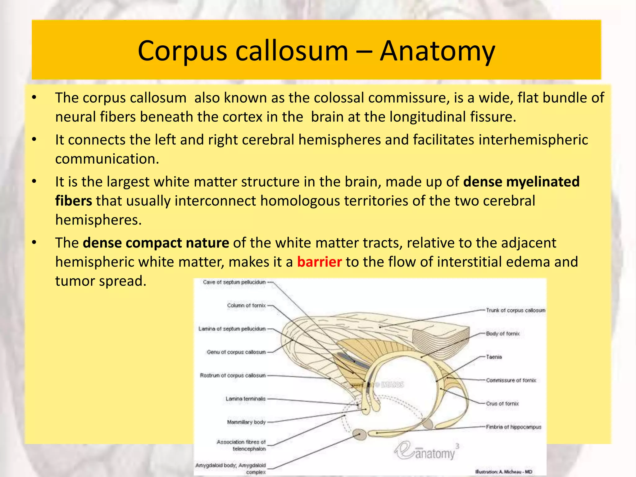 Disorders of corpus callosum | PPTX