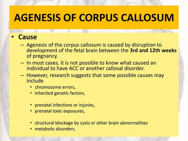 Disorders of corpus callosum | PPTX