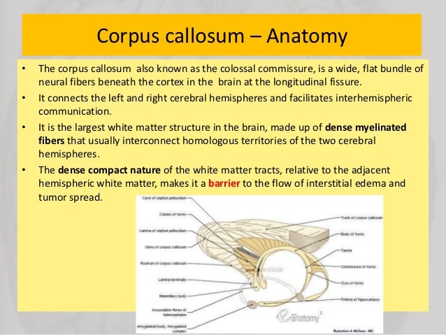Disorders of corpus callosum