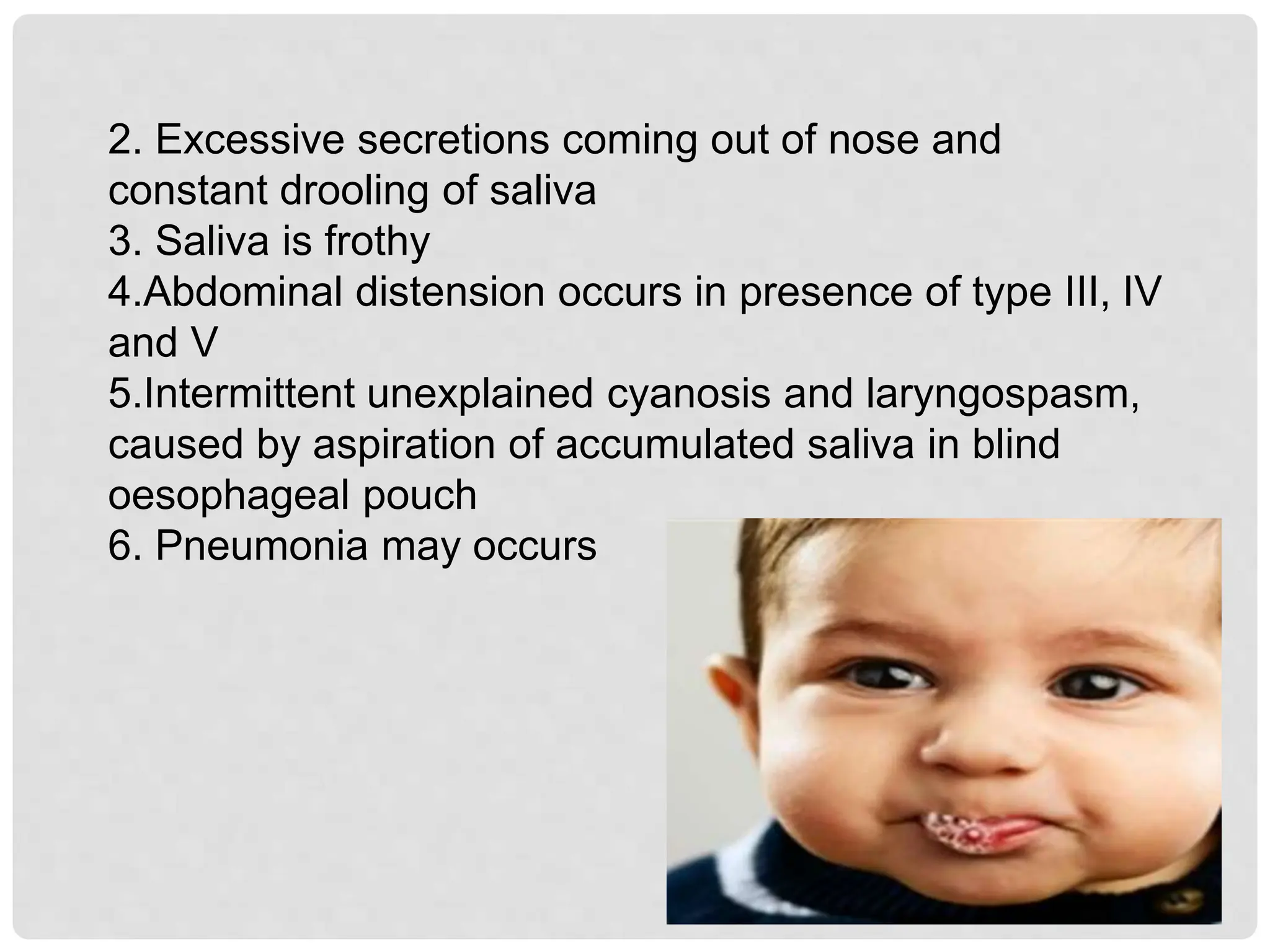Congenital Disorders of digestive tract.pptx