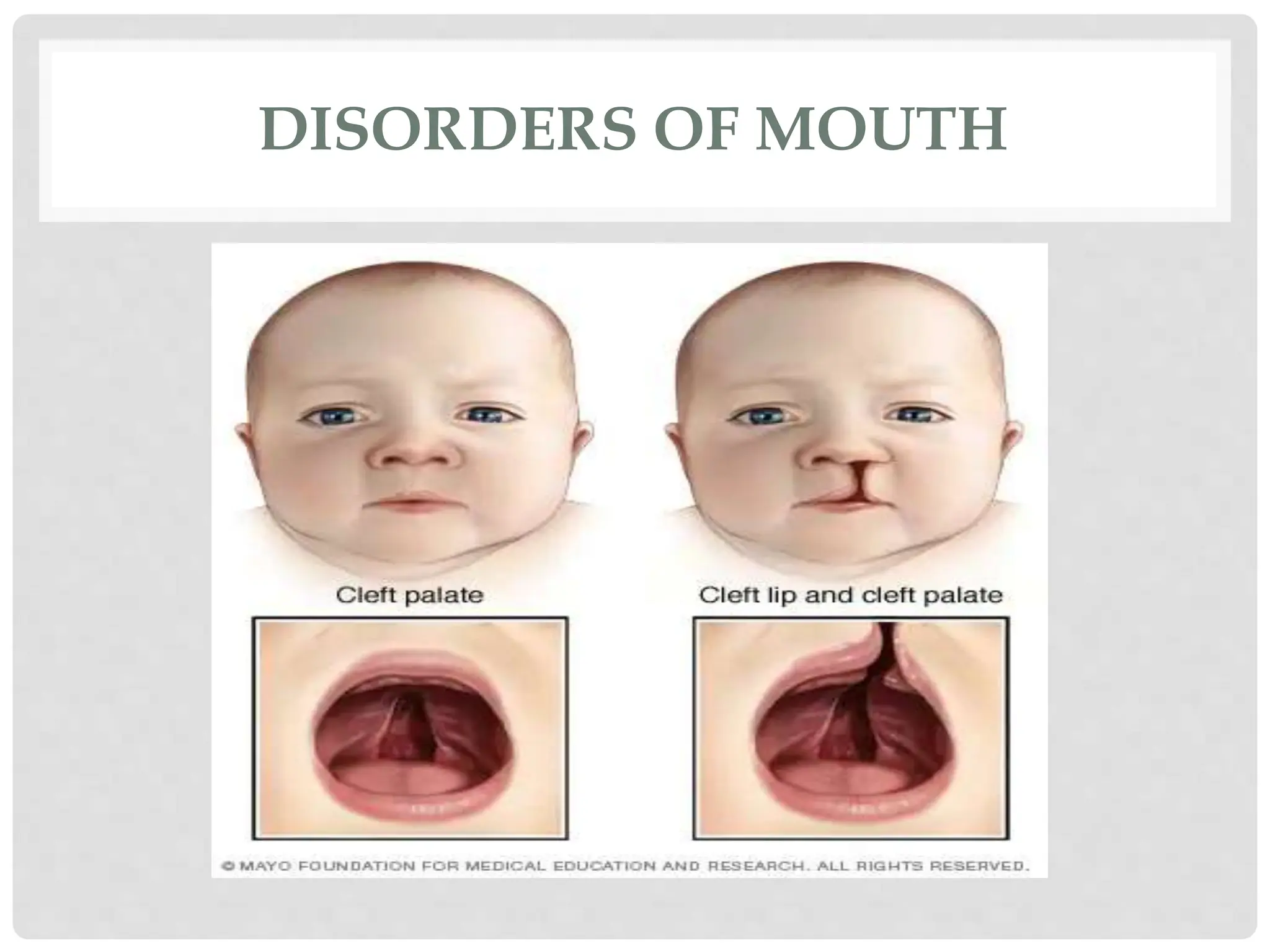 Congenital Disorders of digestive tract.pptx