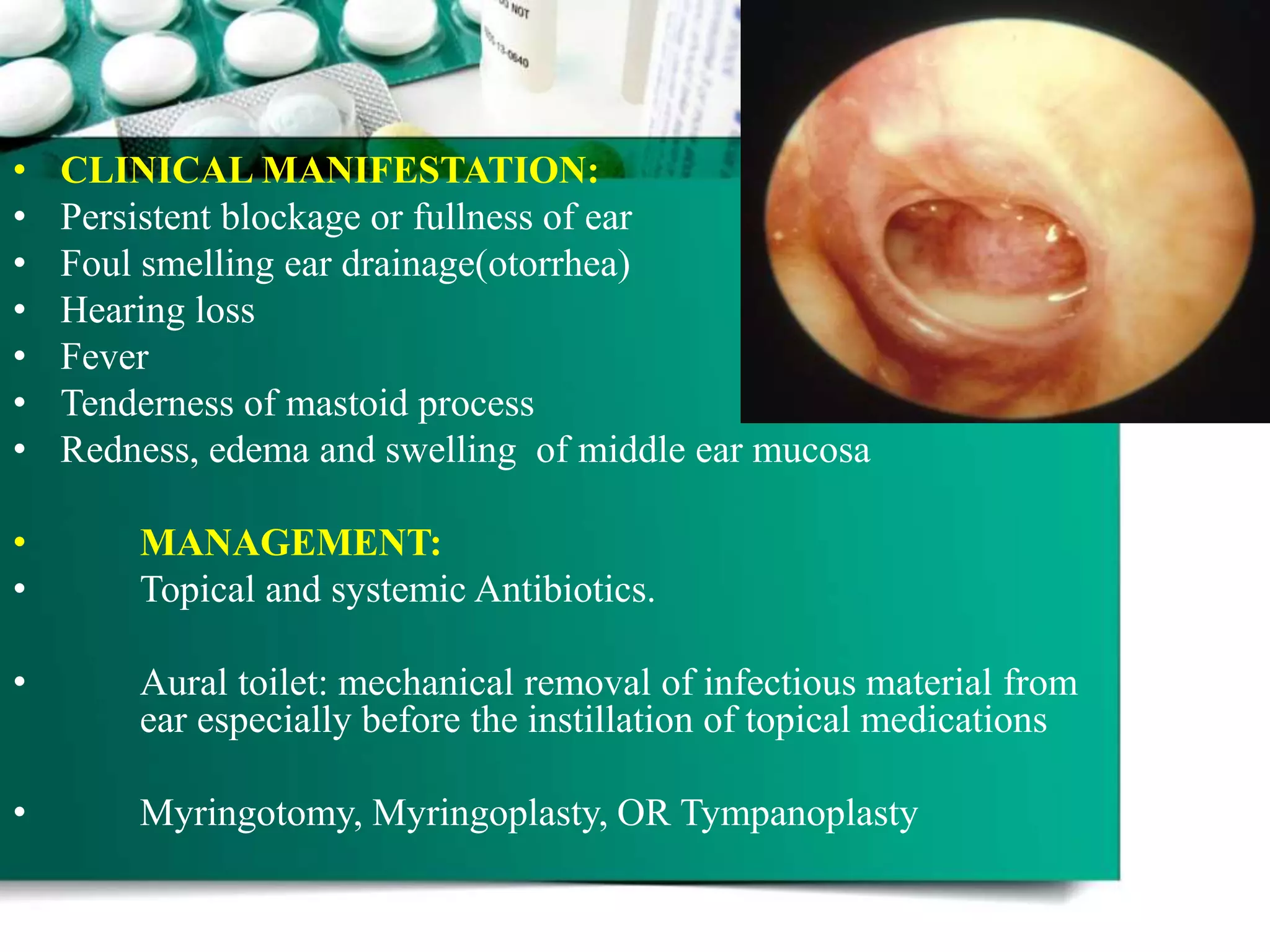 Disorders of ear | PPTX