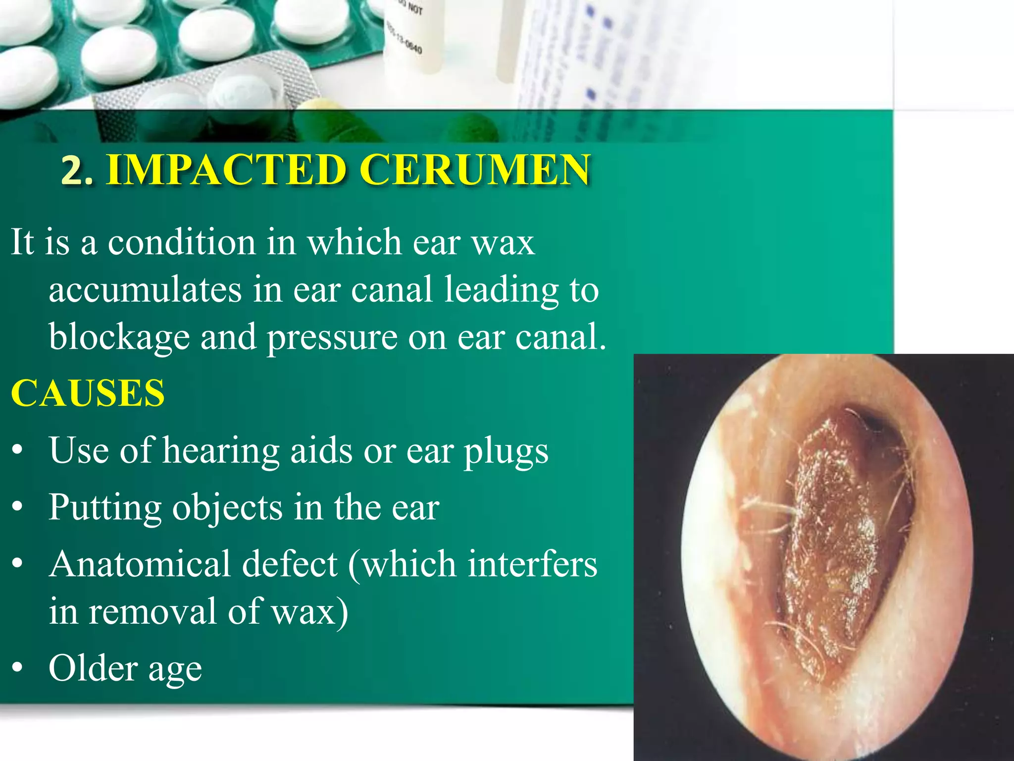 Disorders of ear | PPTX