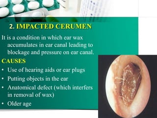 Disorders of ear | PPTX