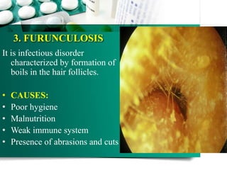 Disorders of ear | PPTX