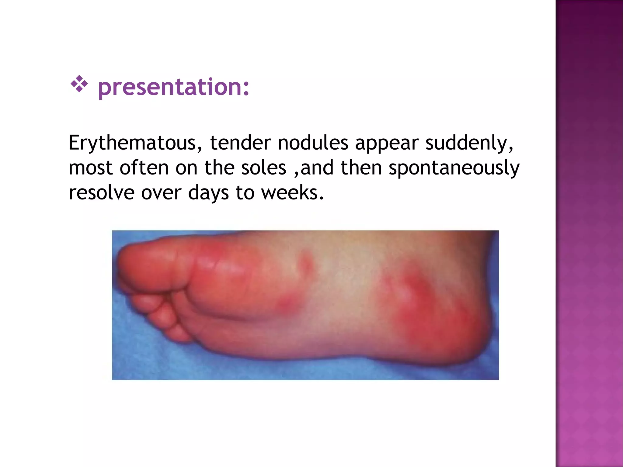 Disorders of Eccrine and Apocrine Sweat Glands | PPT