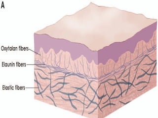Disorders Of Elastic Tissue | PPS
