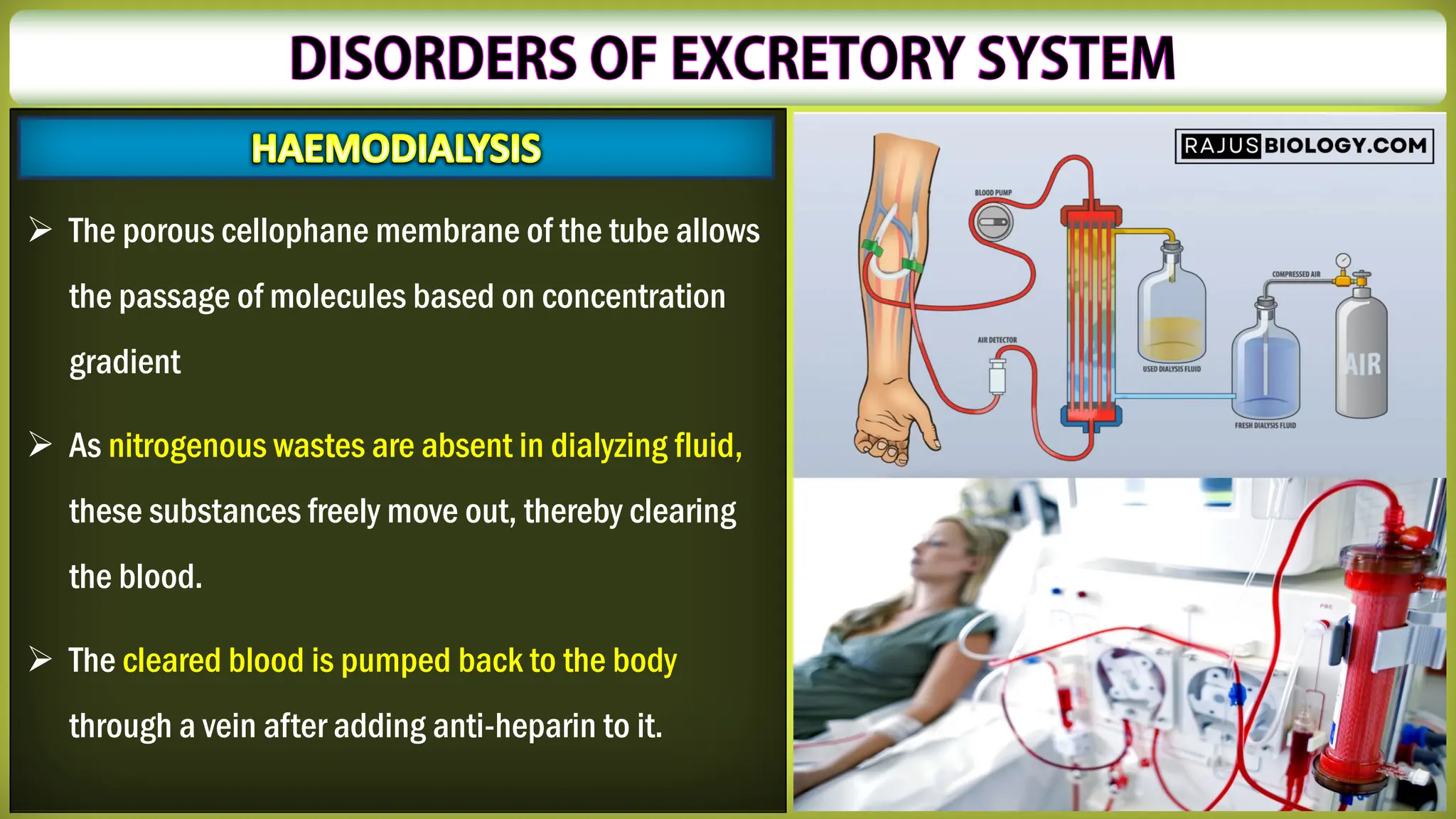 Disorders of excretory system | Human Excretory System.pdf