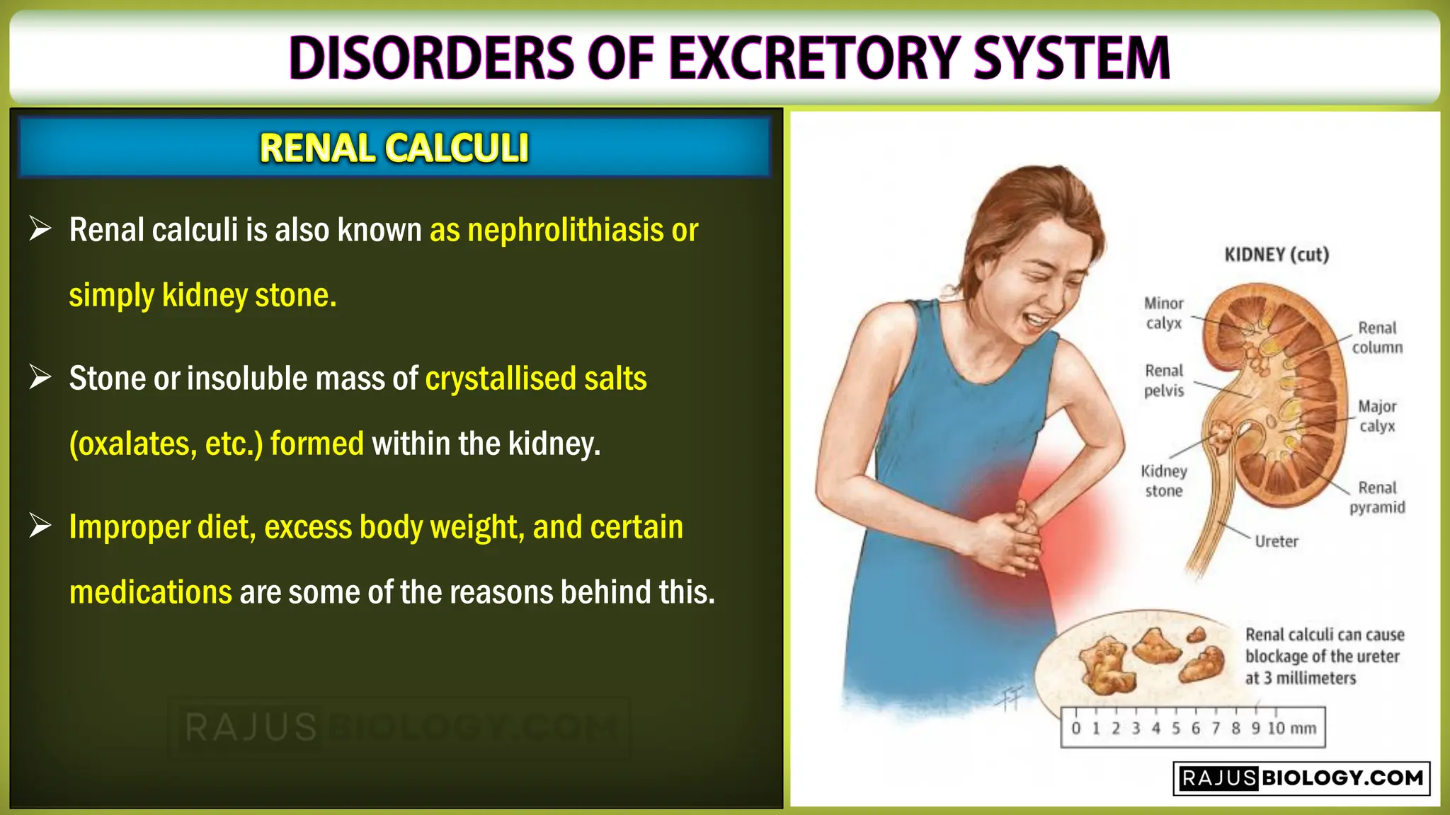 Disorders of excretory system | Human Excretory System.pdf