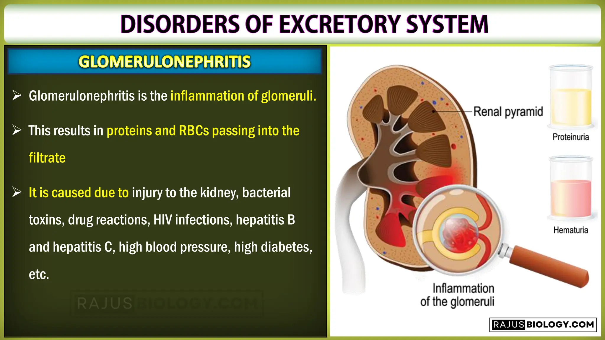 Disorders of excretory system | Human Excretory System.pdf
