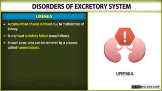 Disorders of excretory system | Human Excretory System.pdf