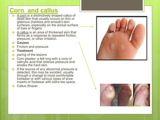 Disorders of feet-Bunion,Marfan Syndrome,Ehlers–Danlos syndrome,Corn ...