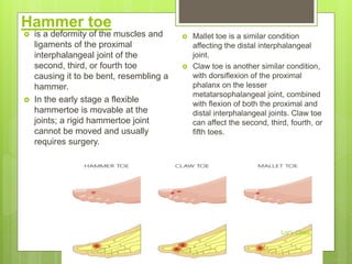 Disorders of feet-Bunion,Marfan Syndrome,Ehlers–Danlos syndrome,Corn ...