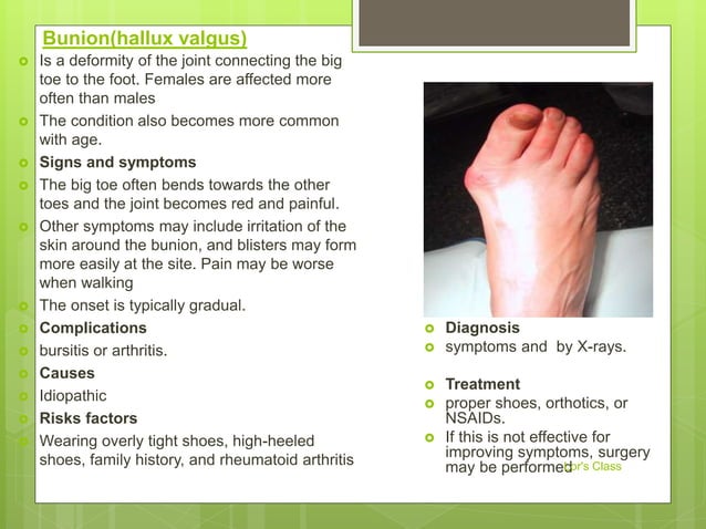 Disorders of feet-Bunion,Marfan Syndrome,Ehlers–Danlos syndrome,Corn ...
