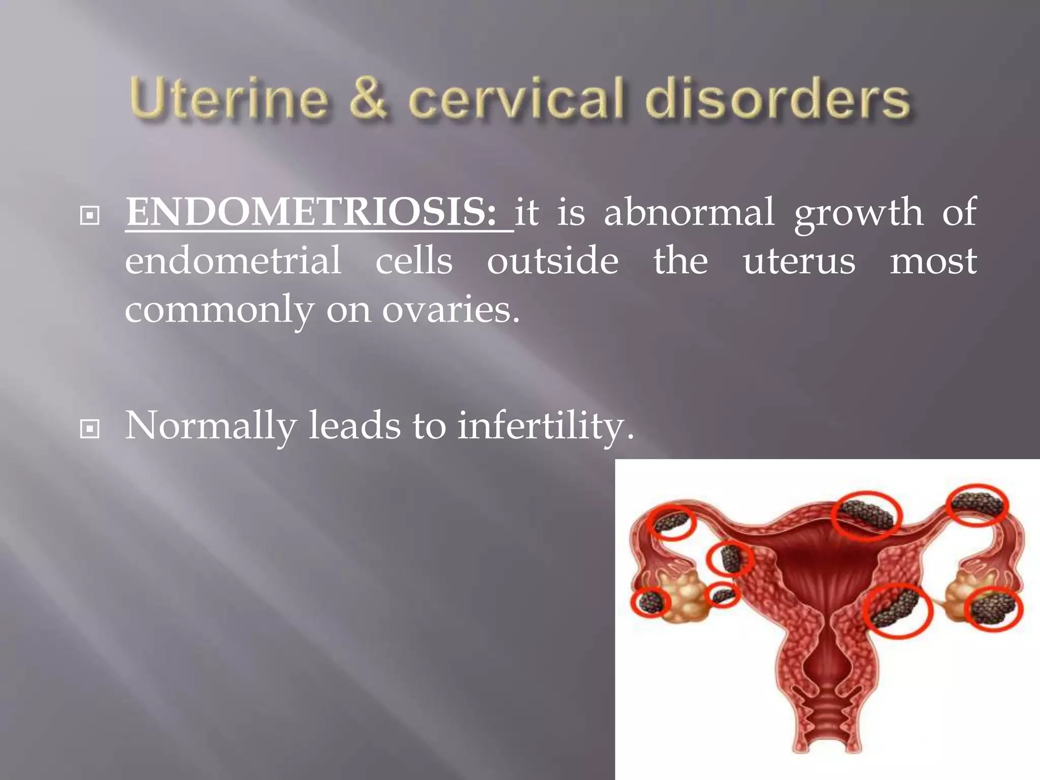 Disorders of female reproductive system | PPTX