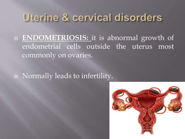 Disorders of female reproductive system | PPTX | Pregnancy ...