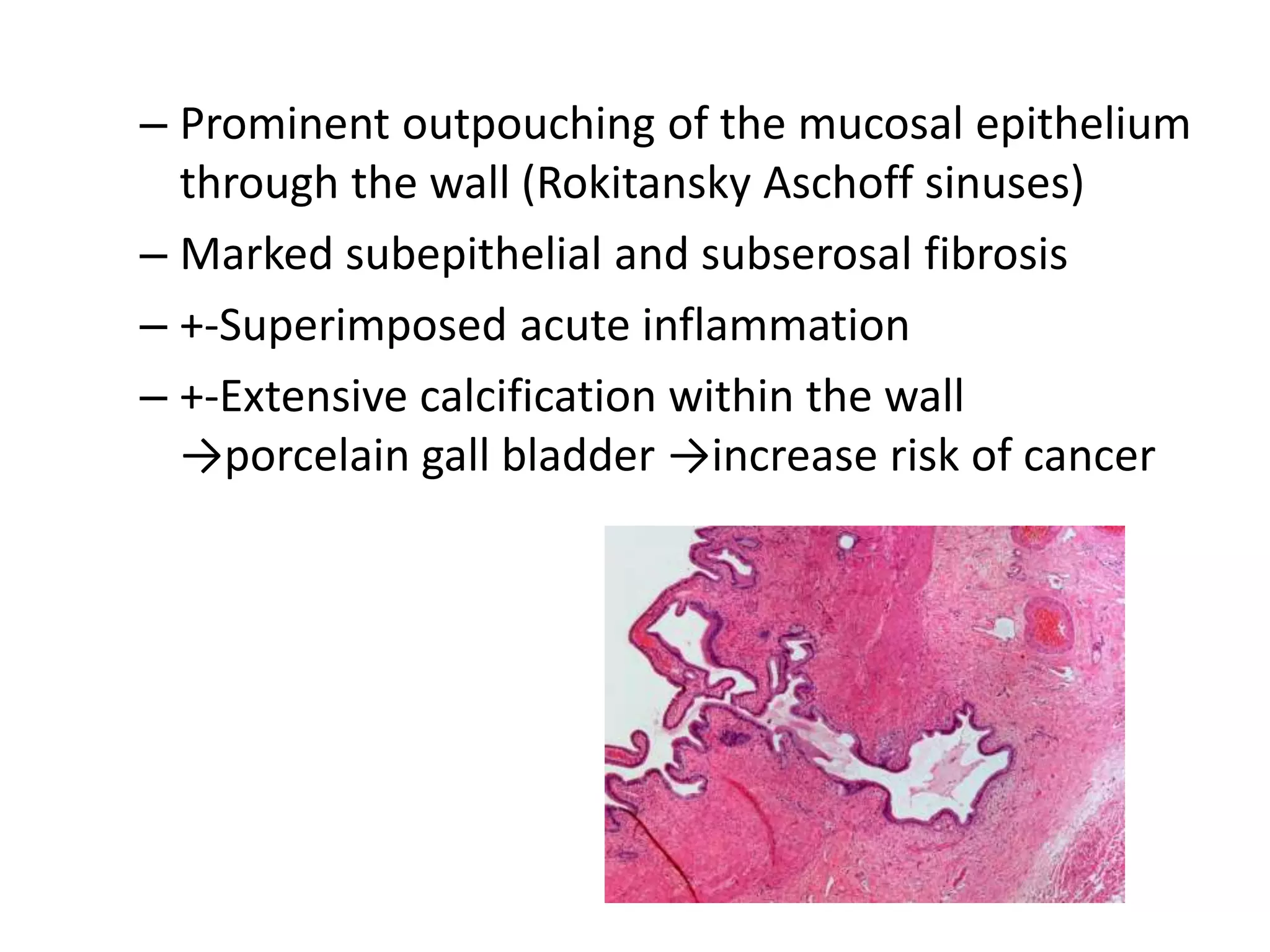 Disorders of gall bladder | PPTX