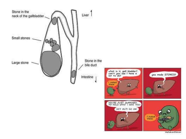 Disorders of gall bladder | PPTX