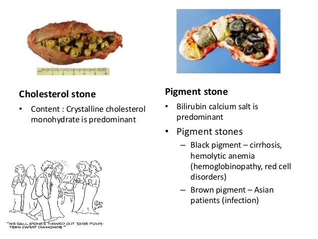 Disorders of gall bladder