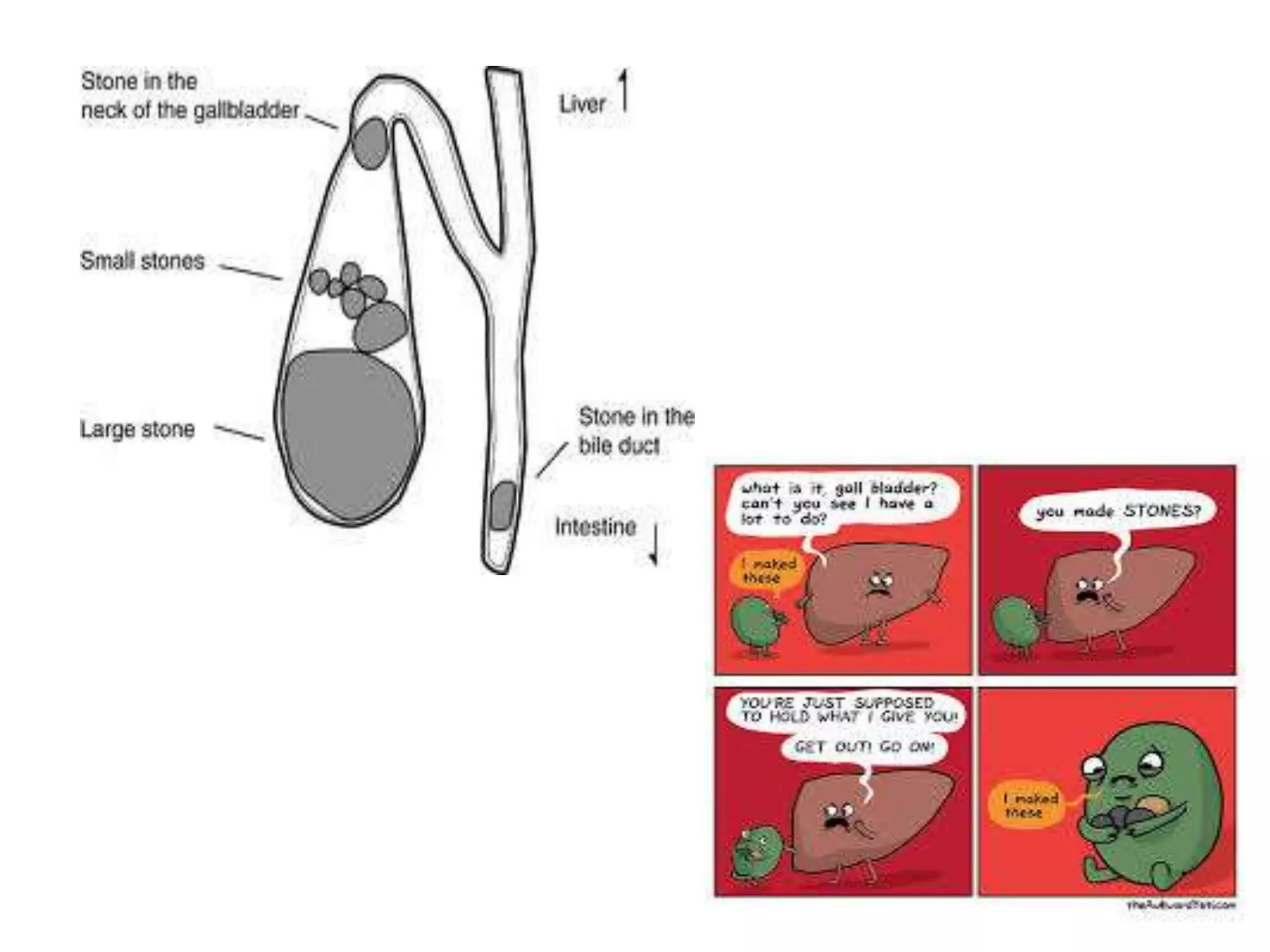 Disorders of gall bladder | PDF