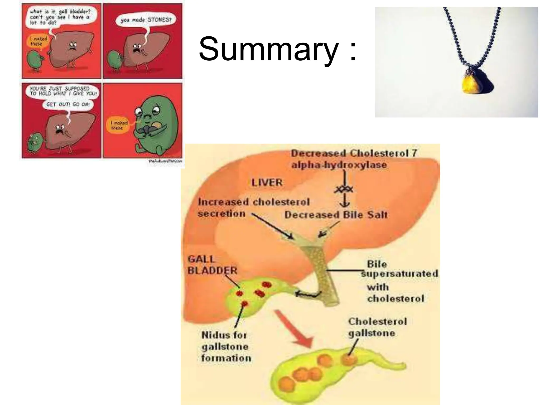disordersofgallbladder (1).pptx