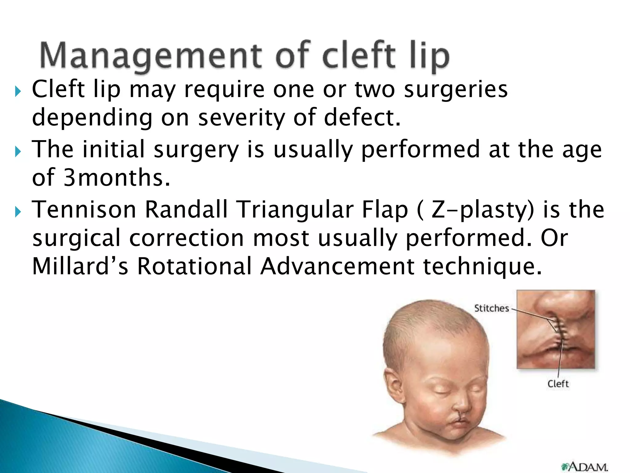 Disorders of gastrointestinal system peds | PPTX