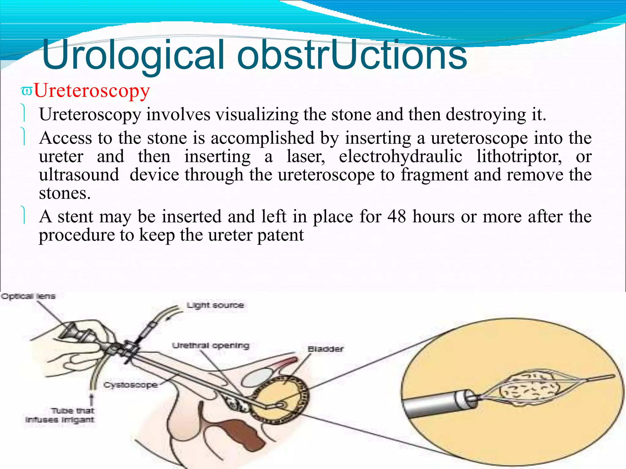Disorders of genitourinary | PPTX