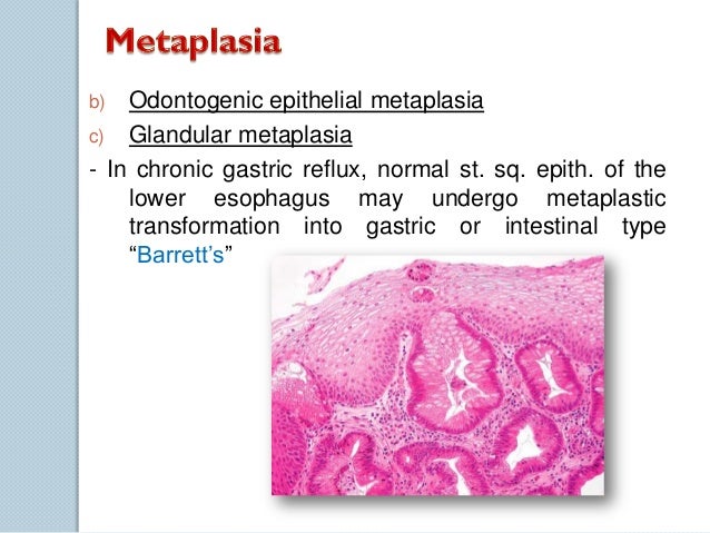 Disorders of growth. General Pathology