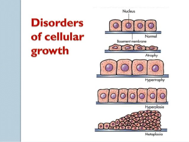 Disorders of growth. General Pathology