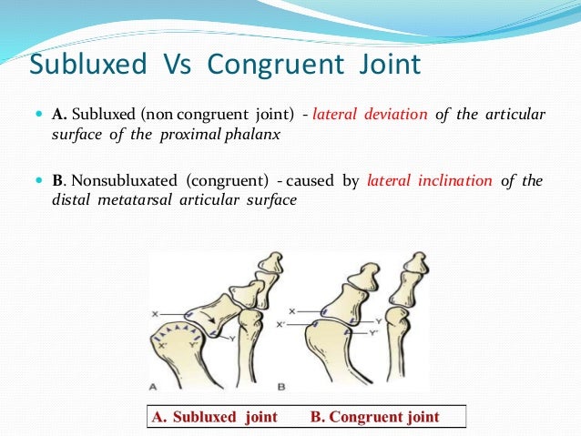 Disorders of hallux