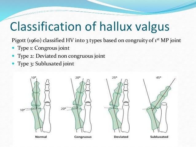 Disorders of hallux