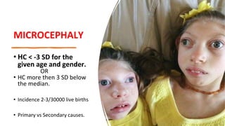 Familial Macrocephaly