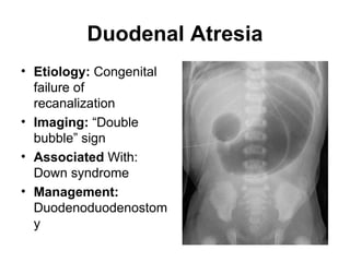 disorders of small and large intestine.ppt
