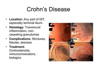disorders of small and large intestine.ppt