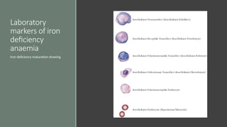 Disorders of iron metabolism and heme synthesis (2).pptx