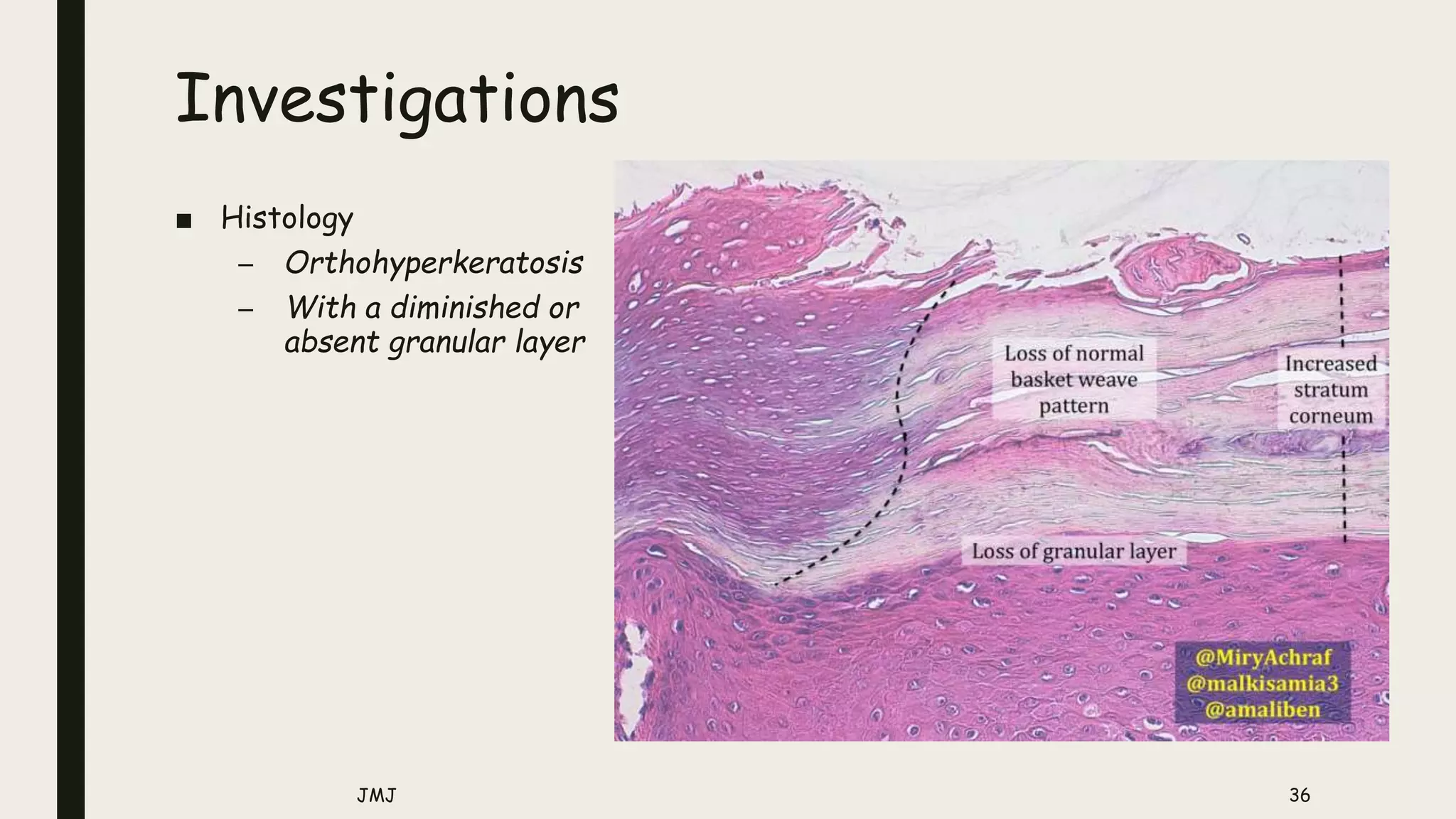Disorders of keratinization | PPTX