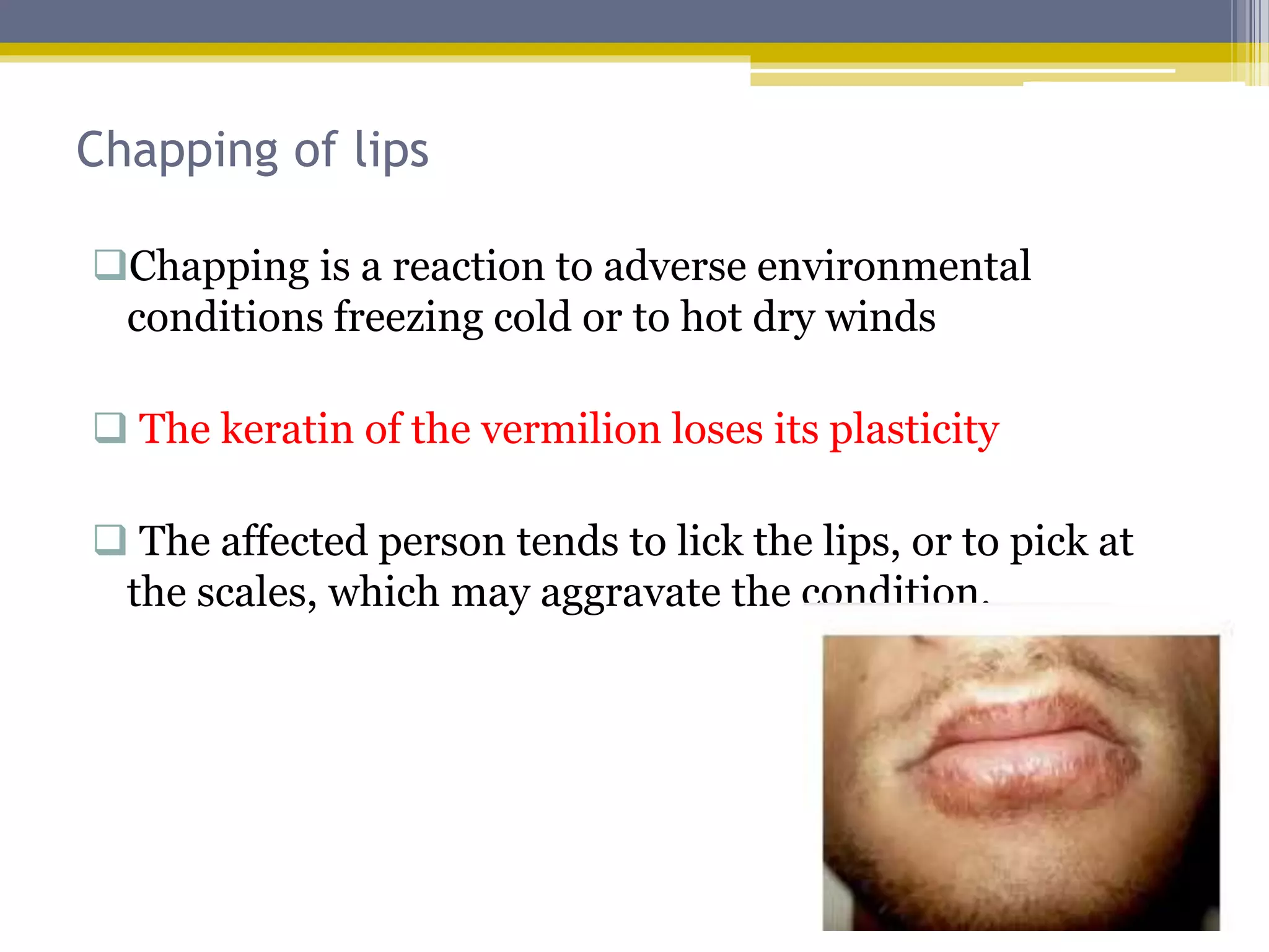 Disorders of lip | PPTX