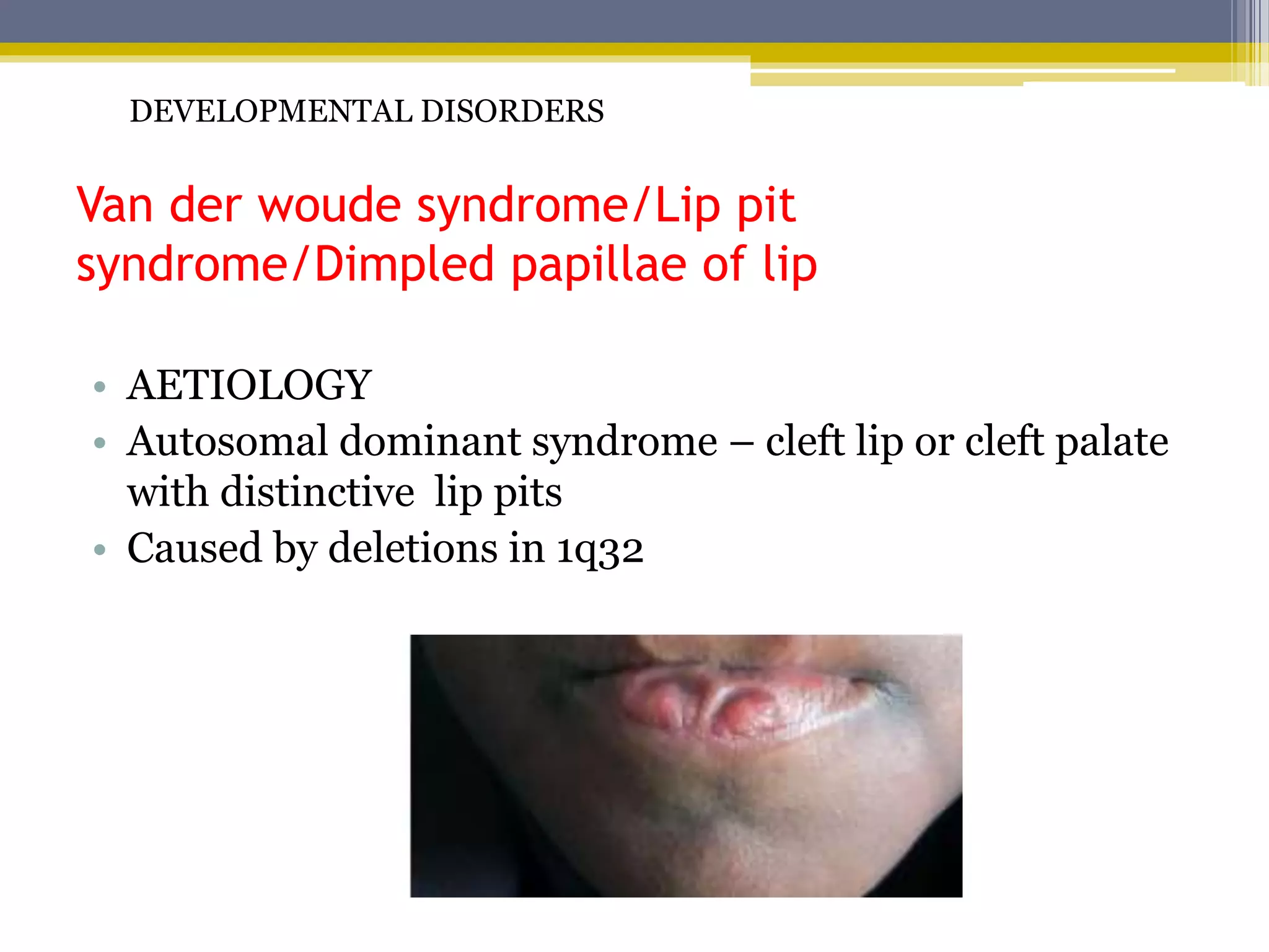 Disorders of lip | PPTX