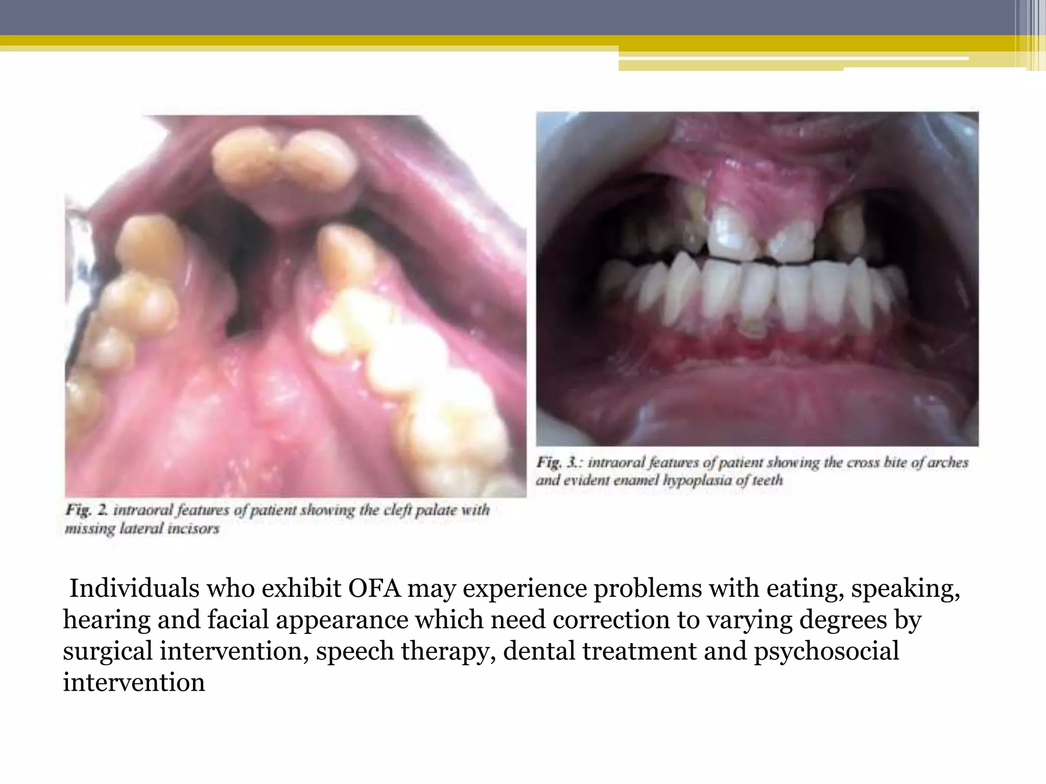Disorders of lip | PPTX